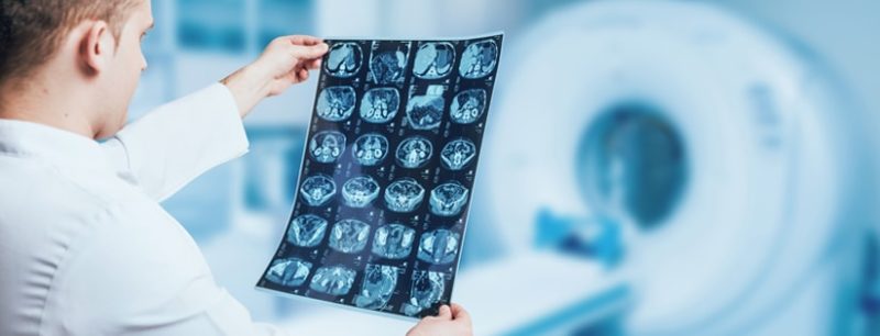 [Blog] How AI + Automation Optimizes Prior Authorization for Medical ...